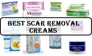 Best Scar Removal Creams : Top 5 Reviews And Buying Guide