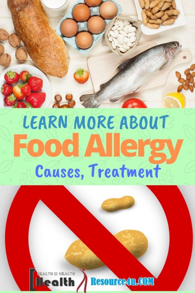 Food Allergic Problem Causes Symptoms And Its Treatment